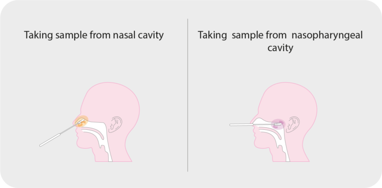 Nasal swab is almost as effective as nasopharyngeal swab - Biomedal
