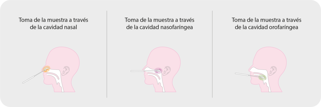 Recogida de muestra nasal reOpenTest - Biomedal